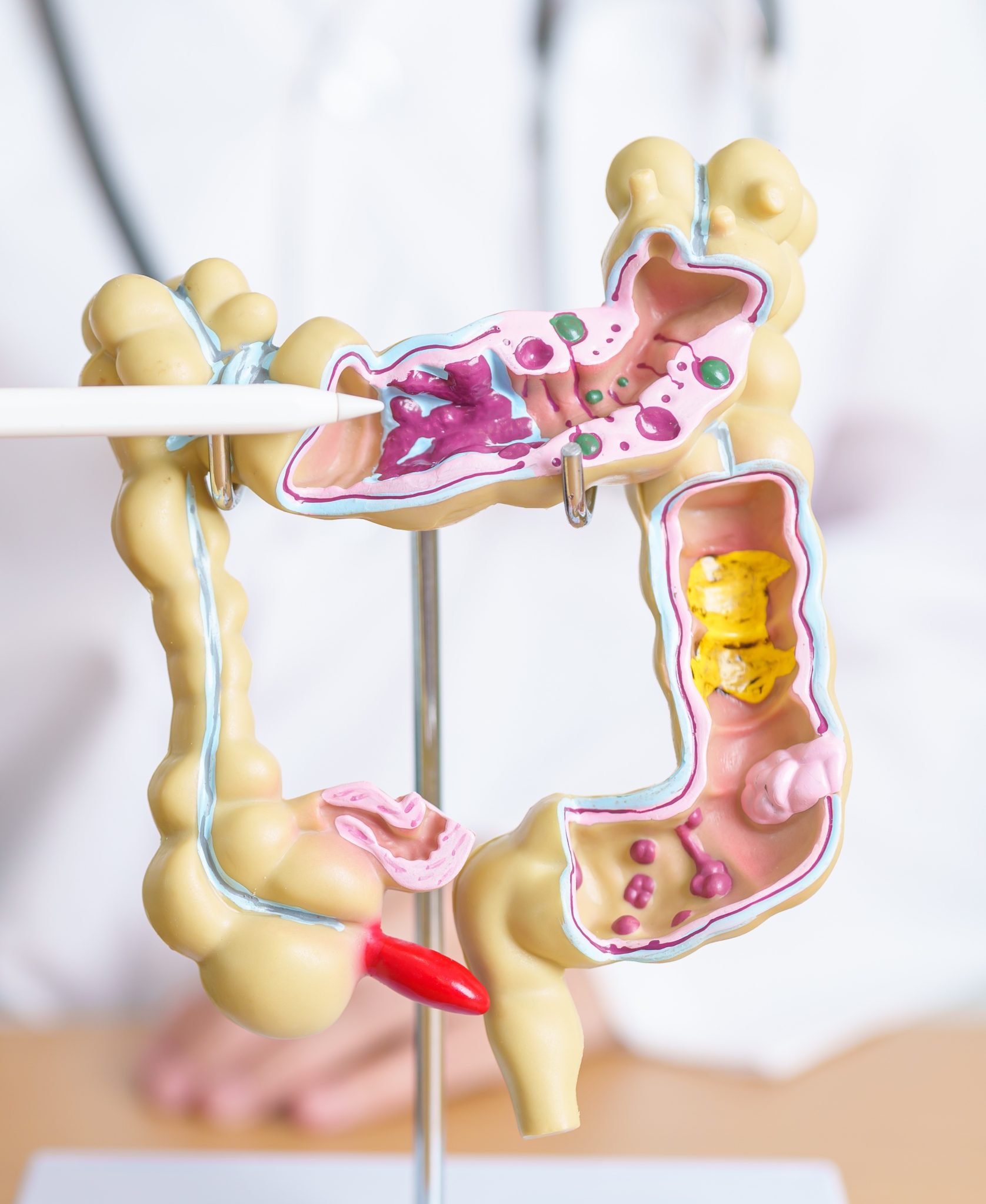 The Ultimate Guide to GI Mapping for Gut Health